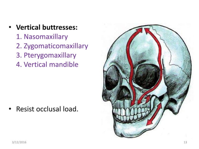 Mid facial fractures and their management | PPTX