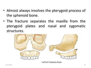 Mid facial fractures and their management | PPTX