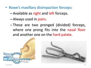Mid facial fractures and their management | PPTX