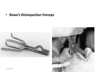 Mid facial fractures and their management | PPTX