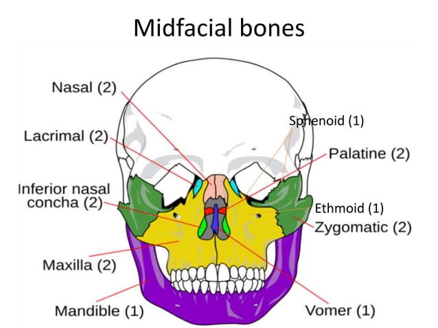 Mid facial fractures and their management | PPTX