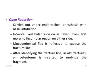 Mid facial fractures and their management | PPTX