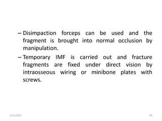 Mid facial fractures and their management | PPTX
