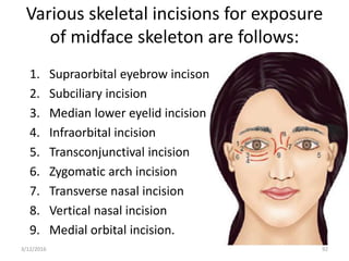 Mid facial fractures and their management | PPTX