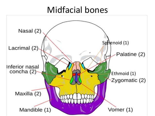 Mid facial fractures and their management