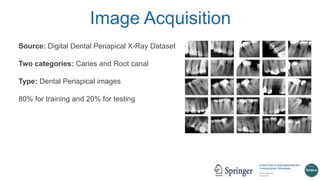 Object Detection on Dental X-ray Images using R-CNN | PPT