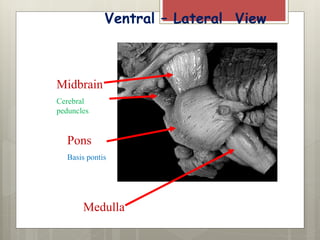 clinical anatomy of mid brain | PPTX