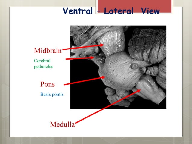 clinical anatomy of mid brain | PPT