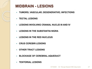 Midbrain | PPTX | Brain and Nervous System Disorders | Diseases and ...