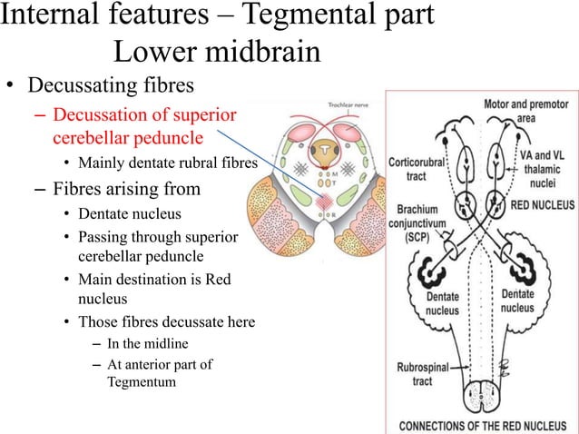Midbrain | PDF | Brain and Nervous System Disorders | Diseases and Conditions
