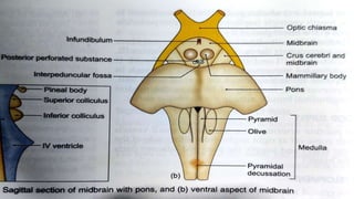 Mid brain | PPTX