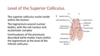 Mid brain anatomy and vascular syndromes | PPTX