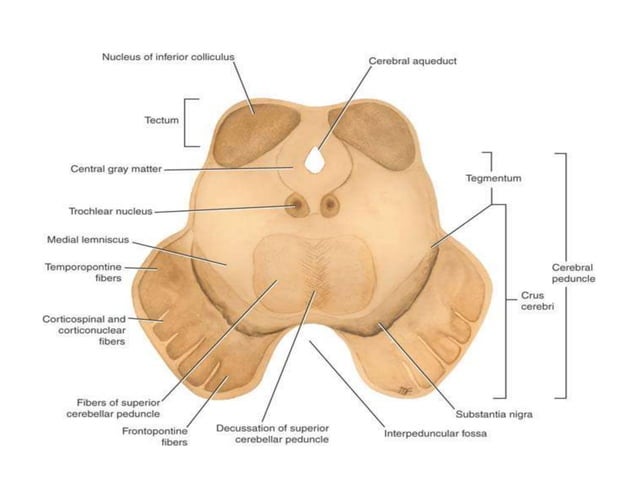 Midbrain-Neuroradiology | PPTX