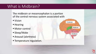 Midbrain activation | PPSX
