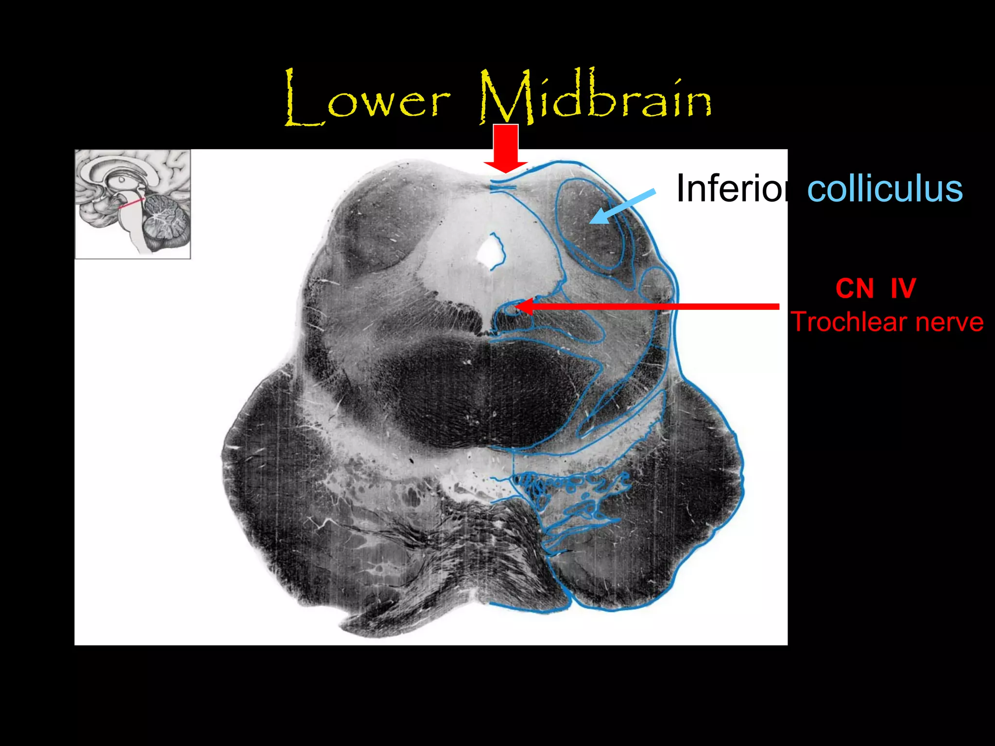 MIDBRAIN ANATOMY | PPT