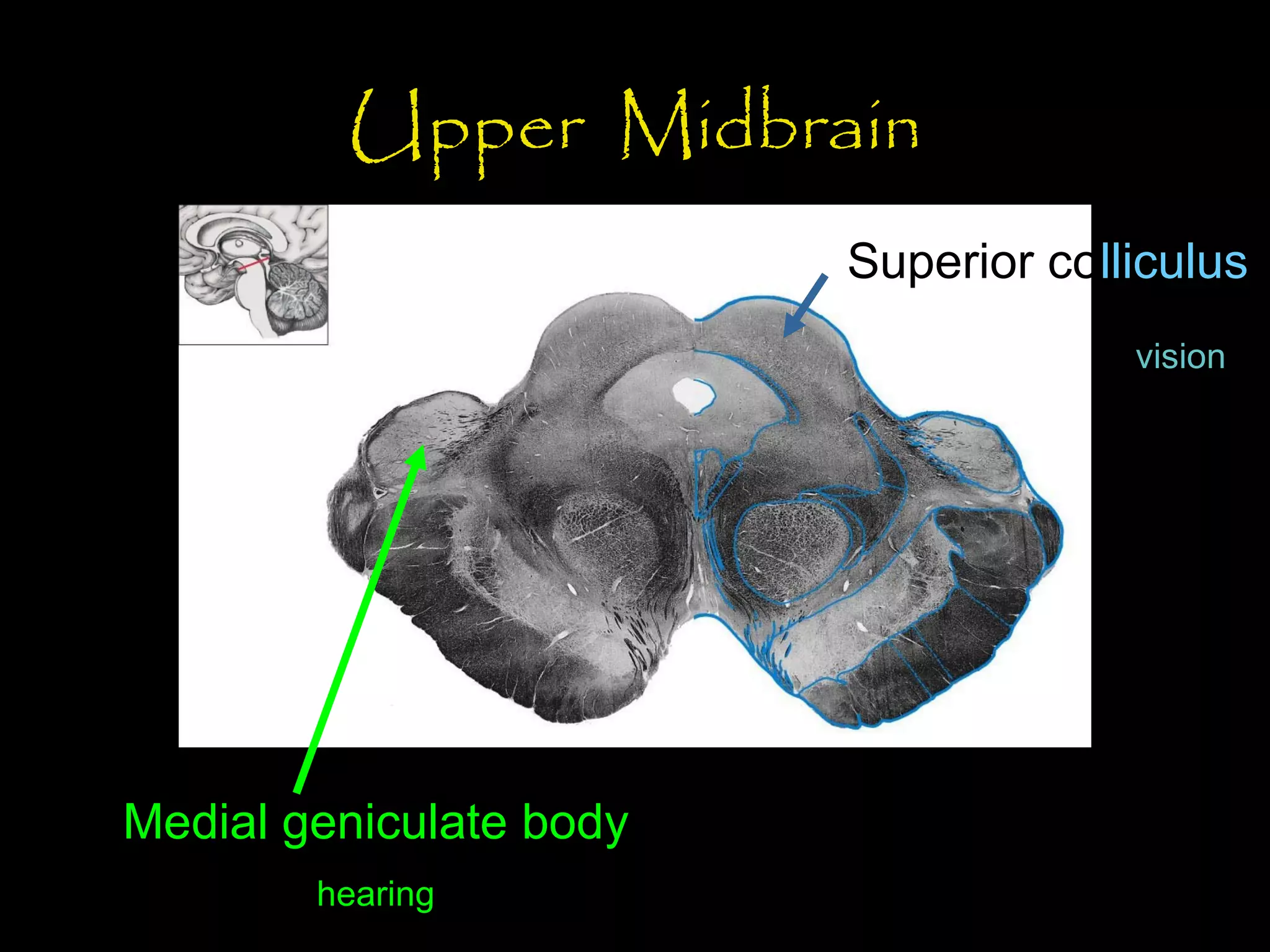 MIDBRAIN ANATOMY | PPT