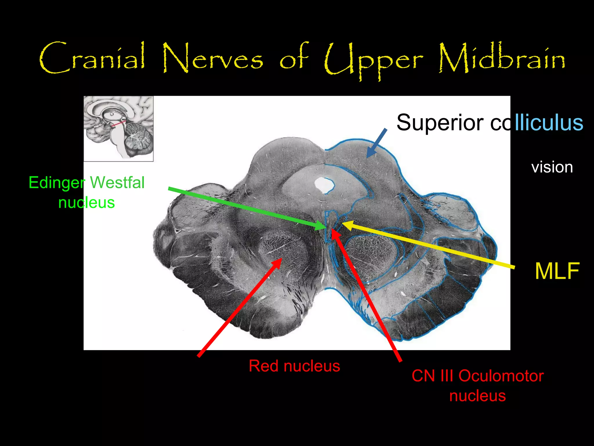 MIDBRAIN ANATOMY | PPT