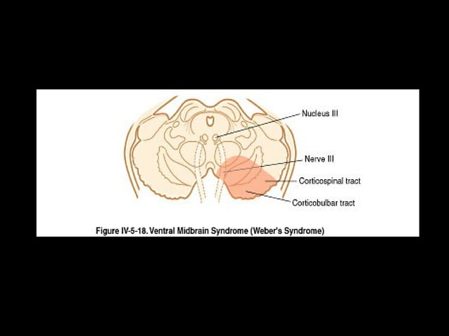 MIDBRAIN ANATOMY | PPT