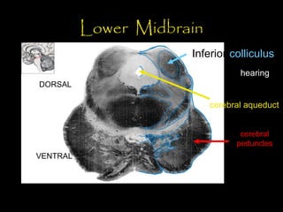 MIDBRAIN ANATOMY | PPT