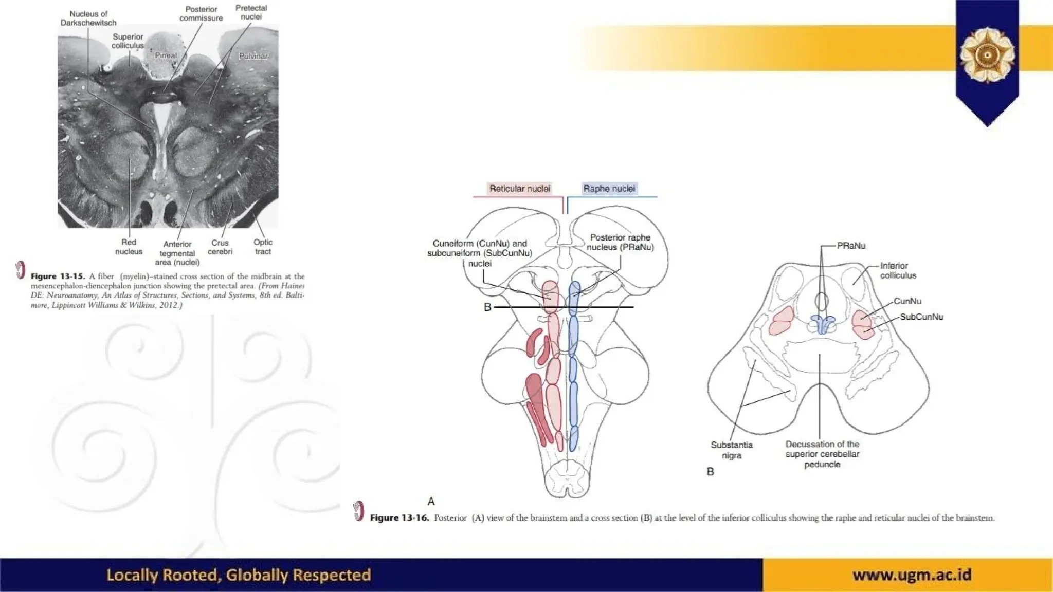 Anatomi Otak fokus pada Midbrain untuk menunjang pemahaman Neuroanatomi ...