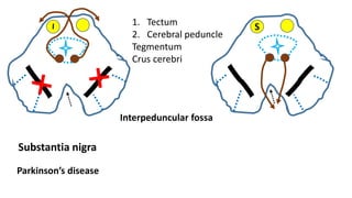 Anatomy of Midbrain and pons | PDF