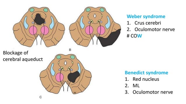 Anatomy of Midbrain and pons | PDF | Death, Injury, or Military ...