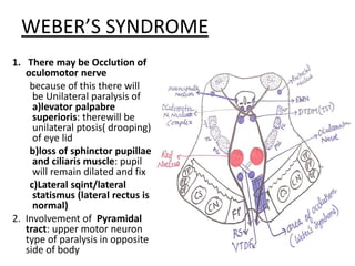 Mid brain part 2 | PPTX