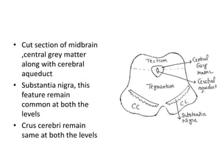 Mid brain part 2 | PPTX