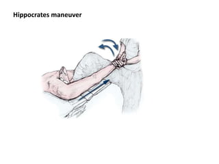 Management of Shoulder dislocations and shoulder instability in sports ...