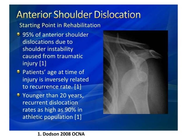 Management of Shoulder dislocations and shoulder instability in sports ...