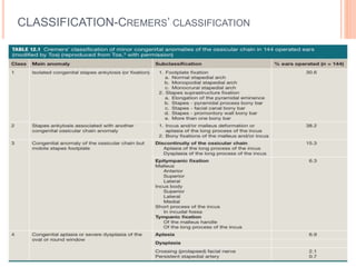 MIDDLE EAR ANOMALIES | PPT