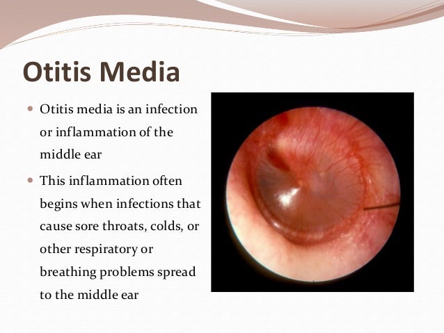 Middle and inner ear 15416