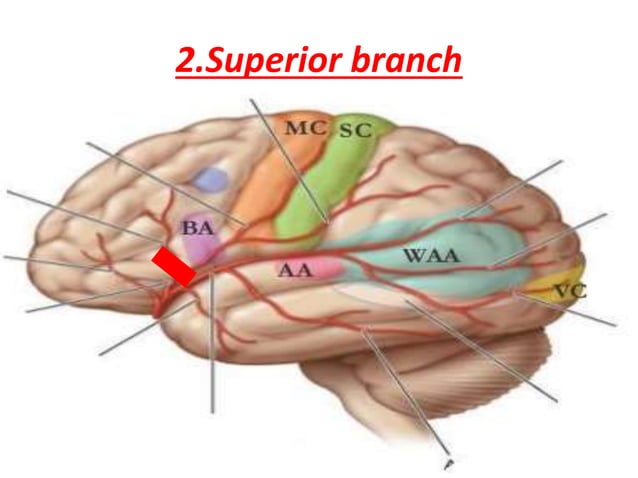 Middle cerebral artery branches | PPTX