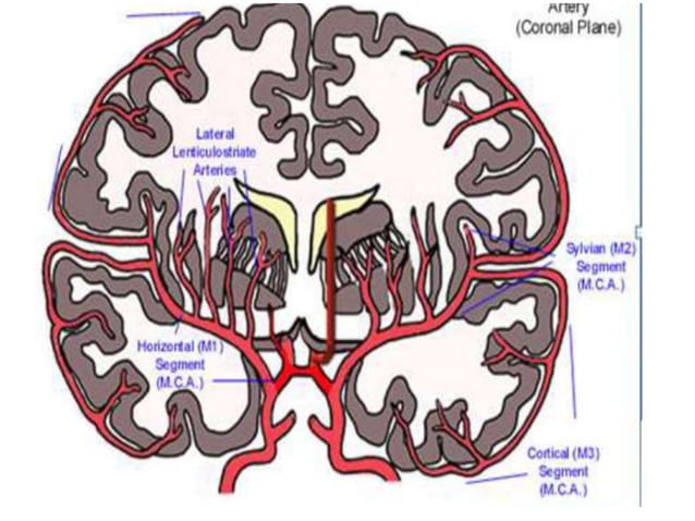 Middle cerebral artery branches | PPTX