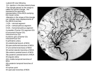 Middle Cerebral Artery (MCA) - Interventional Neuroradiology.pdf