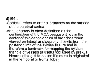 Middle Cerebral Artery (MCA) - Interventional Neuroradiology.pdf