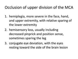 Middle Cerebral Artery Syndromes | PPTX