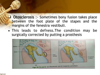 Middle ear | PDF