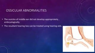 Middle ear | PPTX