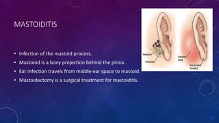 Middle ear | PPTX | Ear, Nose and Throat Conditions | Diseases and ...