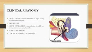 MIDDLE EAR ANATOMY OTORHINOLARYNGOLOGY.pptx
