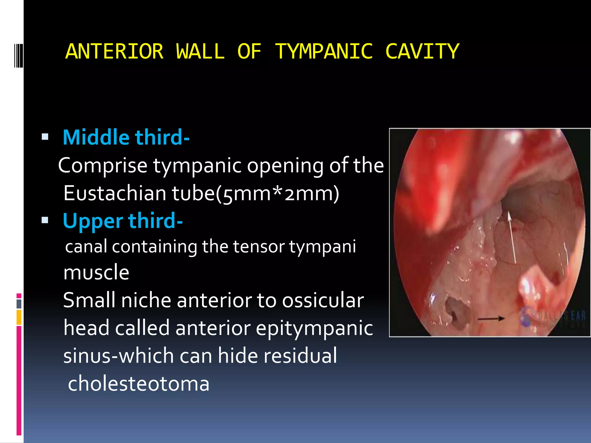 Anatomy Of Middle Ear Cleft | PPTX