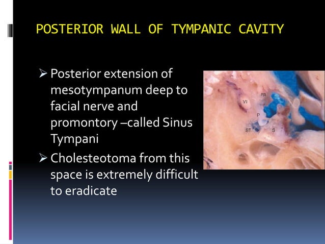 Anatomy Of Middle Ear Cleft | PPTX