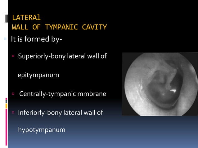 Anatomy Of Middle Ear Cleft | PPTX