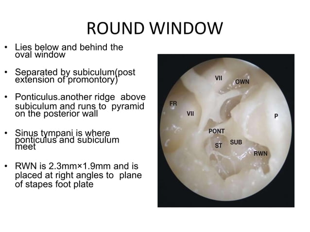 middle ear anatomy and eustachian tube dysfunction .pptx | Ear, Nose ...