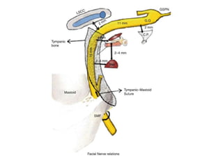 middle ear anatomy and eustachian tube dysfunction .pptx