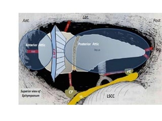 middle ear anatomy and eustachian tube dysfunction .pptx