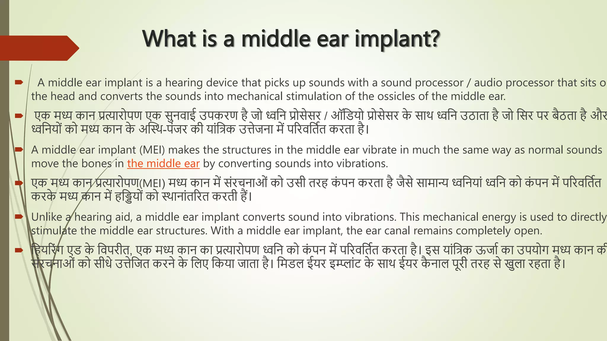 middle ear implant.pptx