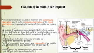 middle ear implant.pptx