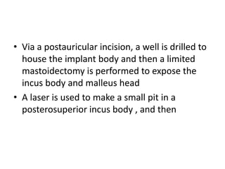 MIDDLE EAR IMPLANT Detailed POWERPOINT PRESENTATION | PPTX